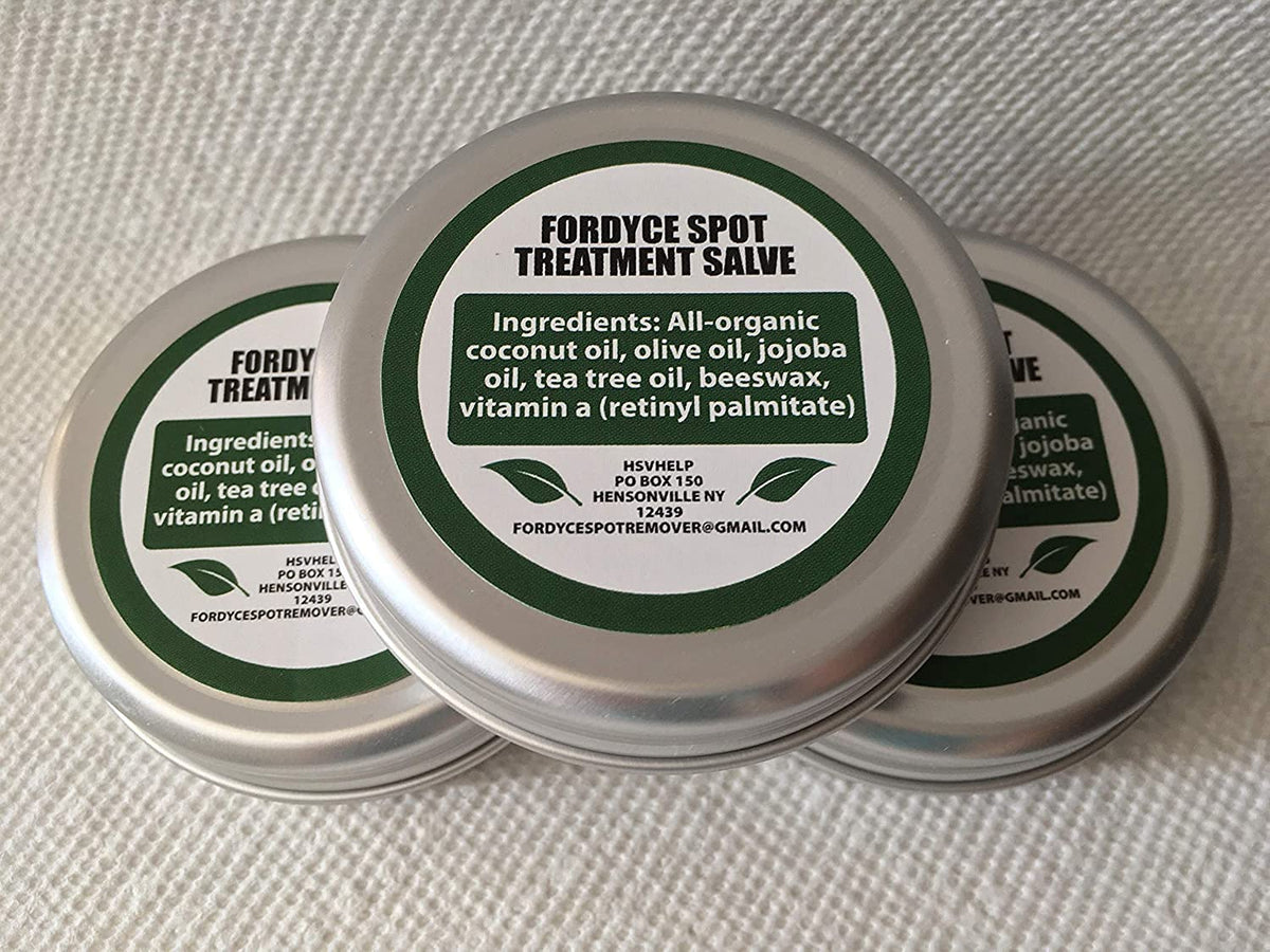 Fordyce Spot Remover - Spots Removal Cream Treatment - Reduces size an ...